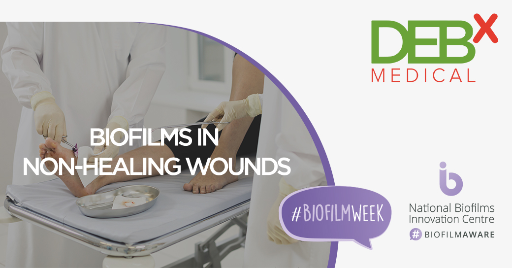 NBIC's Biofilm Awareness Week: Biofilms in Non-Healing Wounds ...